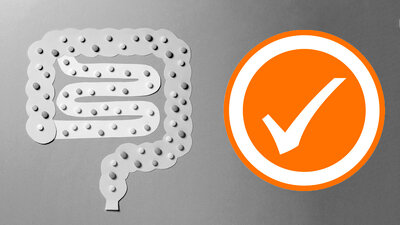 Sind Darmpolypen immer gefährlich? | Apotheken Umschau