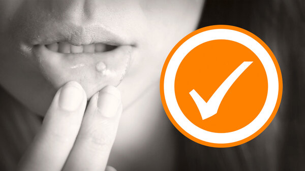 VIANI forte 50 μg/500 μg Diskus Einzeldos.Inh.-P. - Beipackzettel ...