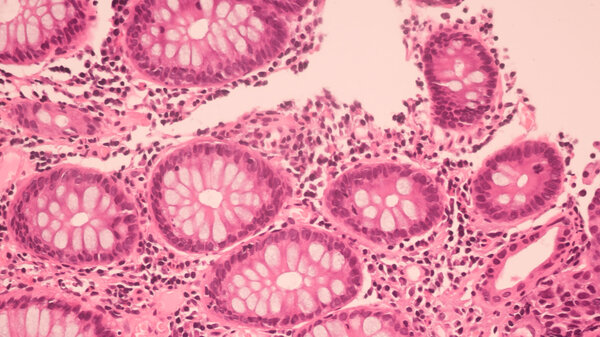 SLENYTO 1 mg Retardtabletten - Beipackzettel | Apotheken Umschau