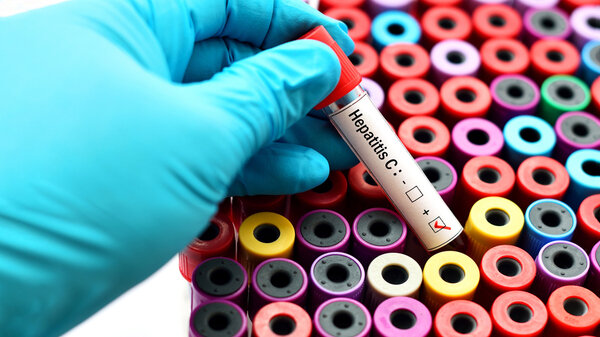 TWINRIX Erwachsene Impfdosis Inj.-Sus.i.e.F-Spr. - Beipackzettel ...