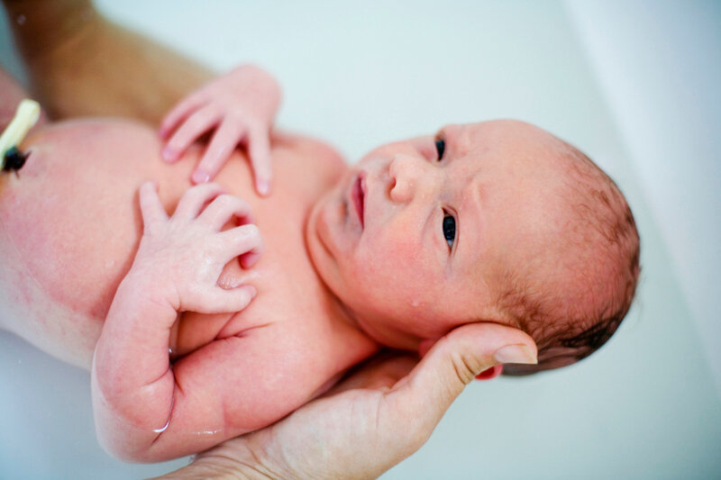 Richtige Nabelpflege bei Neugeborenen | Apotheken Umschau