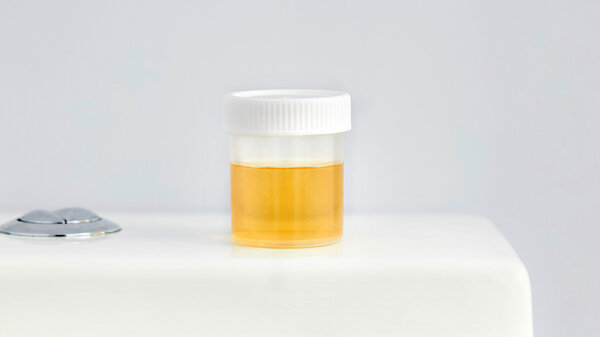 Calcium (Kalzium): Ein wichtiger Mineralstoff | Apotheken Umschau