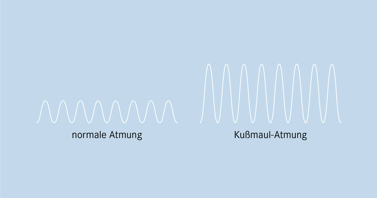 Kußmaul-Atmung | Apotheken Umschau
