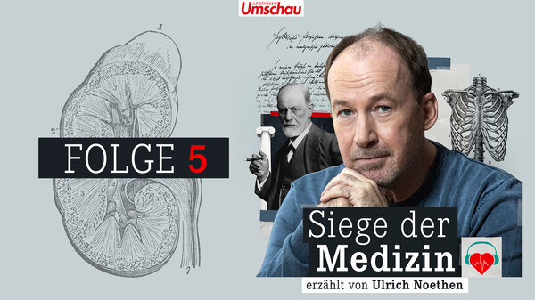 Blutwäsche (Apherese): Bei welchen Krankheiten kommt sie infrage ...