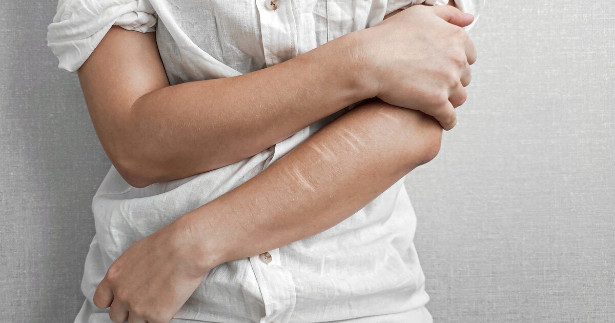 Ritzen: Was tun, wenn mein Kind sich selbst verletzt? | Apotheken Umschau