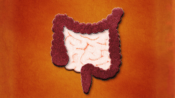 Blinddarmentfernung (Appendektomie) | Apotheken Umschau