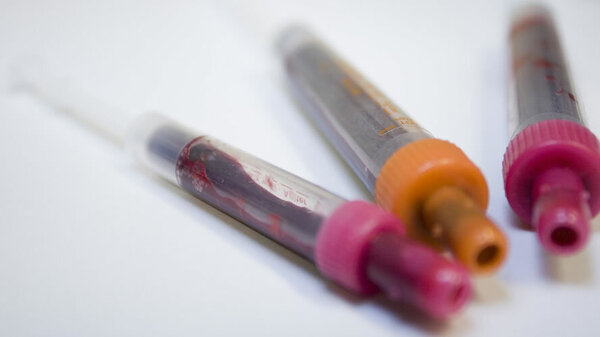 Erythropoetin (EPO): Hormon für die Bildung von Erythrozyten ...