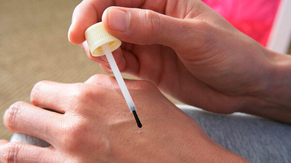 Dellwarzen (Mollusca contagiosa): Symptome und Behandlung | Apotheken ...