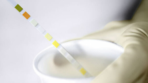 Schaumiger Urin: ist das normal oder gefährlich? | Apotheken Umschau