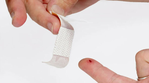 Thrombose: Ursachen, Therapien und Vorbeugung | Apotheken Umschau