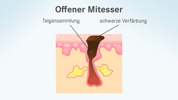 CORDES VAS Creme - Beipackzettel | Apotheken Umschau