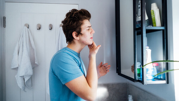 CORDES VAS Creme - Beipackzettel | Apotheken Umschau