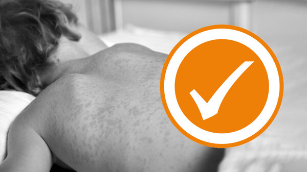 M-M-RvaxPro P.+LM H.Inj.-Susp.Fertigspr.m.Kanüle - Beipackzettel ...