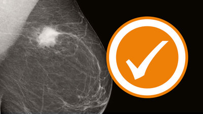 Anatomie: Aufbau der Brust | Apotheken Umschau