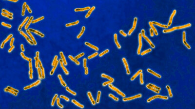 RIAMET Tabletten - Beipackzettel | Apotheken Umschau